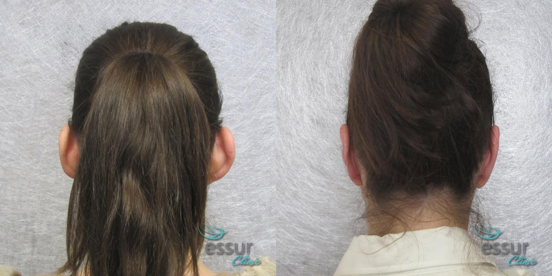 ESSUR Clinic - Estheticon.sk