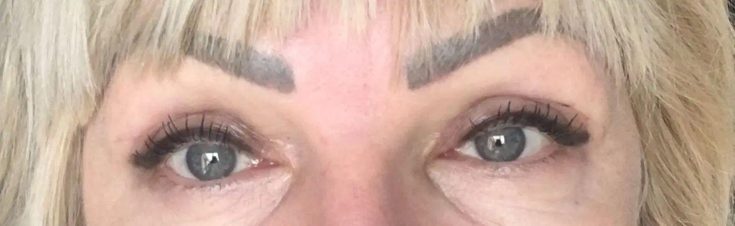 Operácia očných viečok, MUDr. Minarovjech, Bratislava, môžem sa tešiť ...